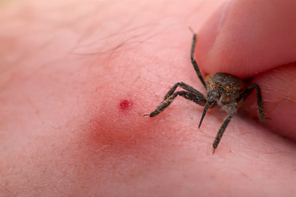 What Does An Assassin Bug Bite Look Like? - WeedBom